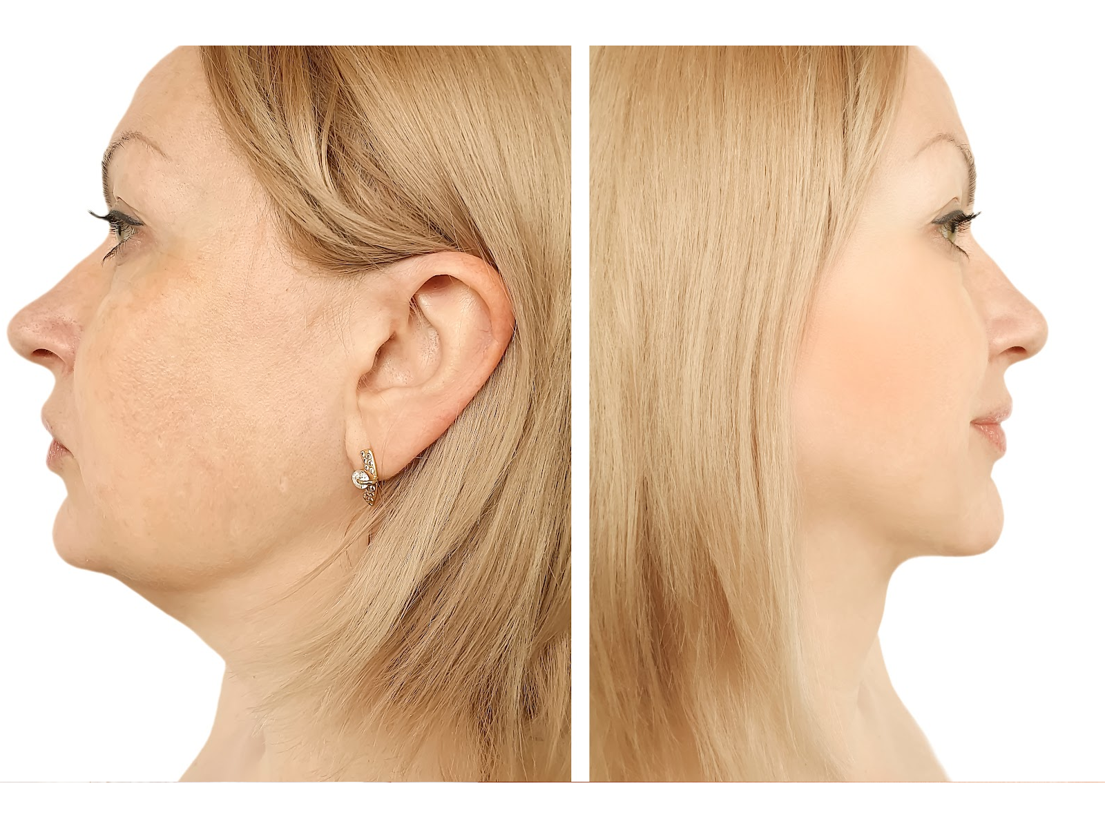 Best face treatment for aging skin and wrinkles near me in Edinburgh