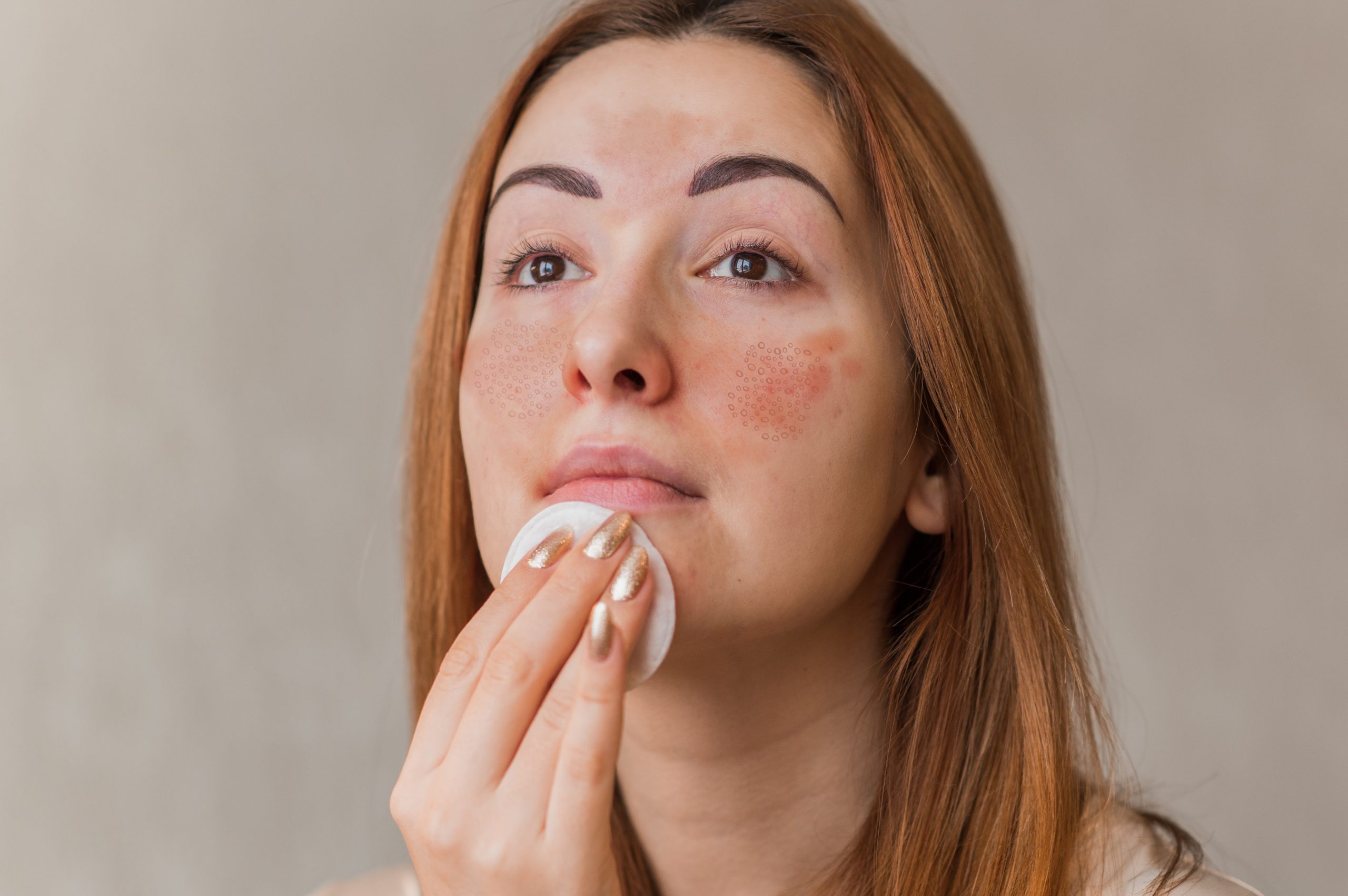 Why is My Face Red? Common Causes of Facial Redness and How to Treat it ...